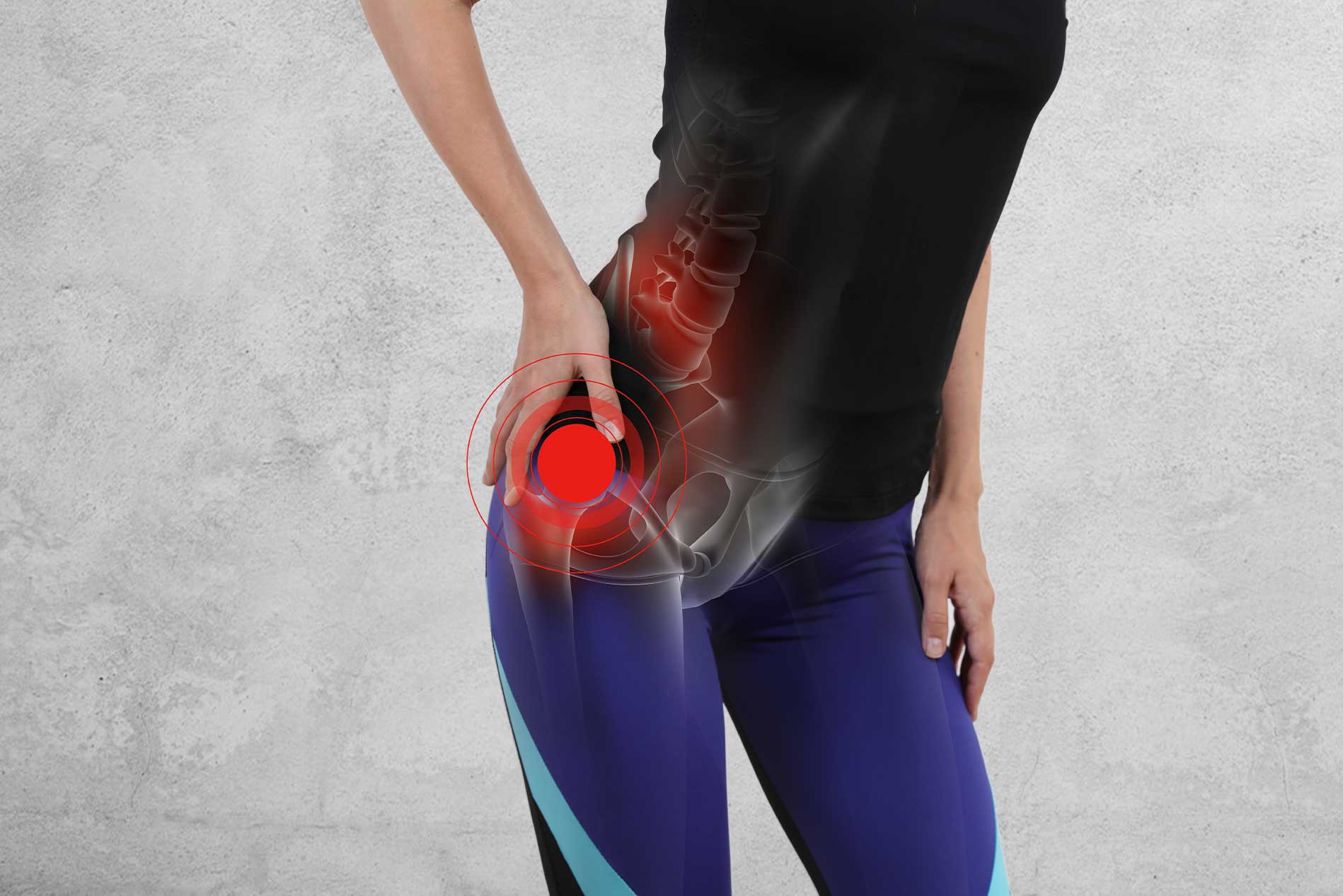 What causes weak hip abductors? - Blackberry Clinic